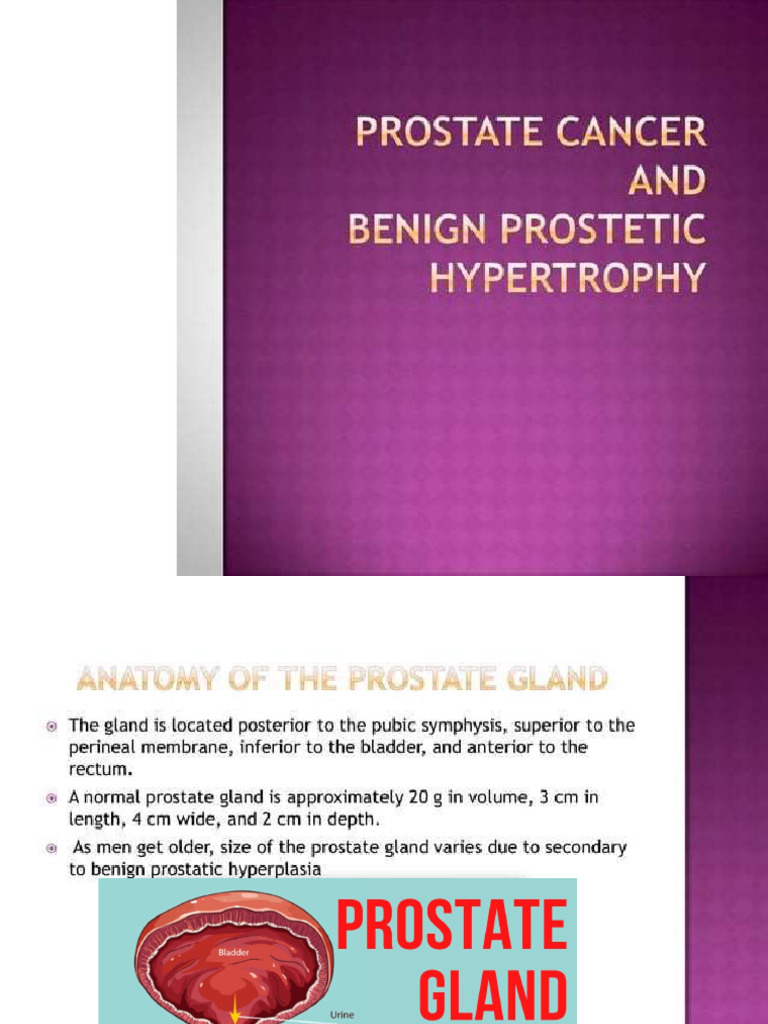 Benign Prostatic Hyperplasia and Prostate Cancer | PDF