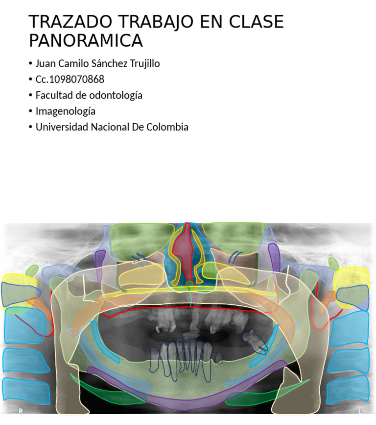 Trazado Trabajo en Clase Panoramica | PDF