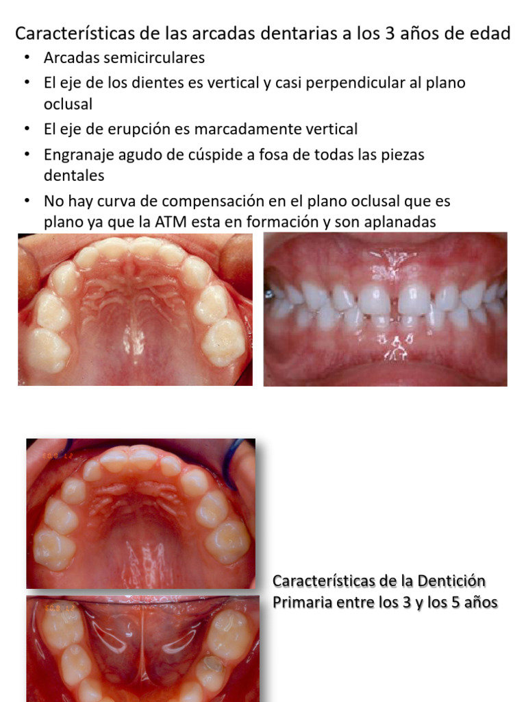 Dentición Primaria | PDF