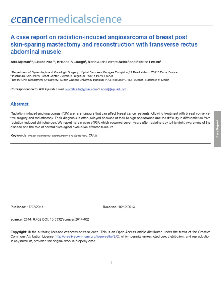 2-A Case Report On Radiation-Induced Angiosarcoma of Breast Post | PDF ...