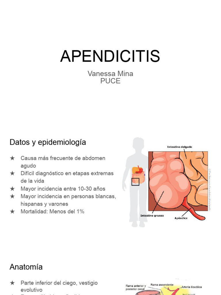 APENDICITIS | PDF | Especialidades Medicas | Medicina CLINICA