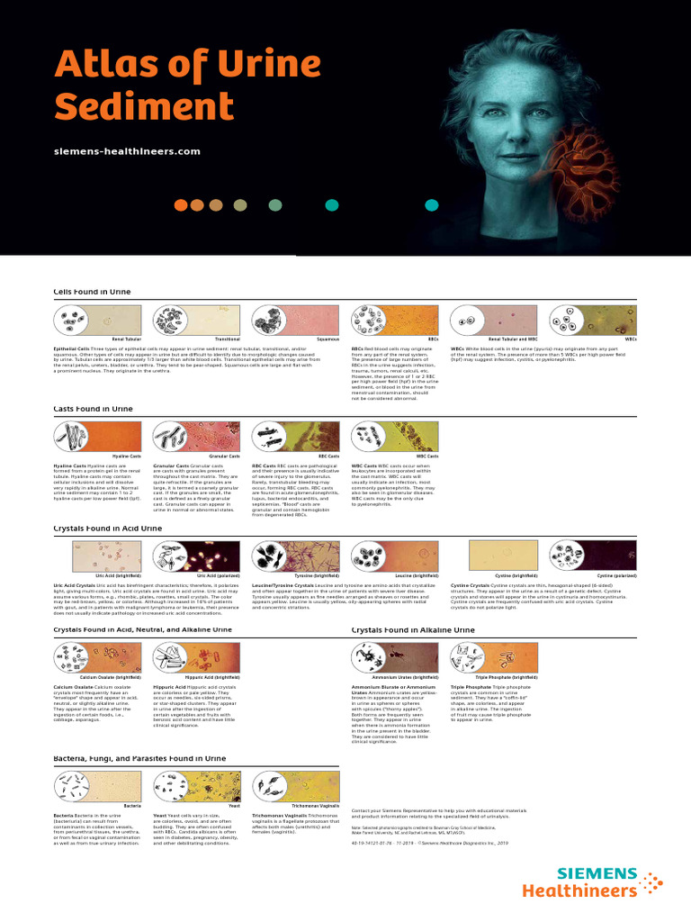 Poc Atlas of Urine Sediment Poster-06864294 1800000006864294 | PDF ...