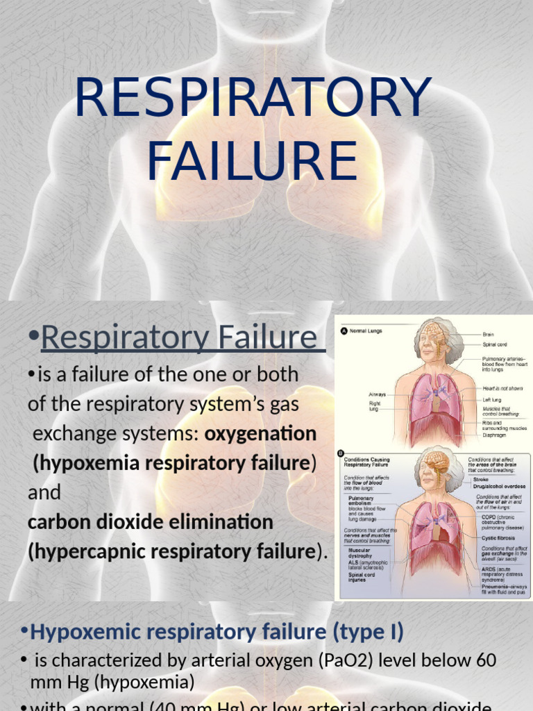 Respiratory Failure PPT 4 | PDF | Breathing | Respiratory System