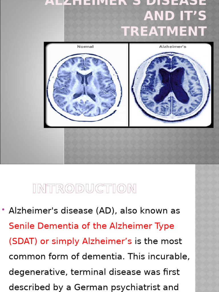 Alzheimers Presentation | PDF | Alzheimer's Disease | Dementia