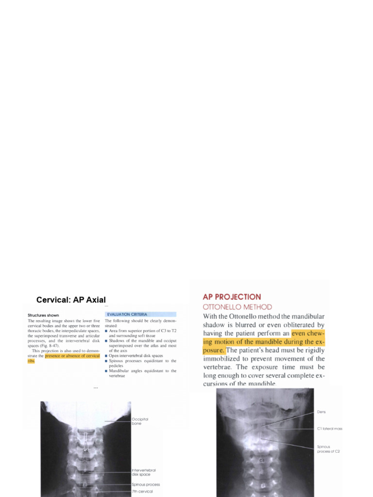 Cervical AP Axial Imaging Guide | PDF