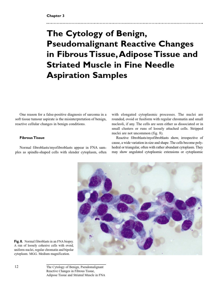 The Cytology of Benign Pseudomalignant Reactive Changes in Fibrous ...