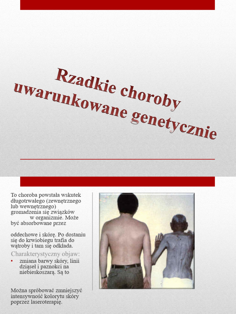 Choroby Genetyczne | PDF