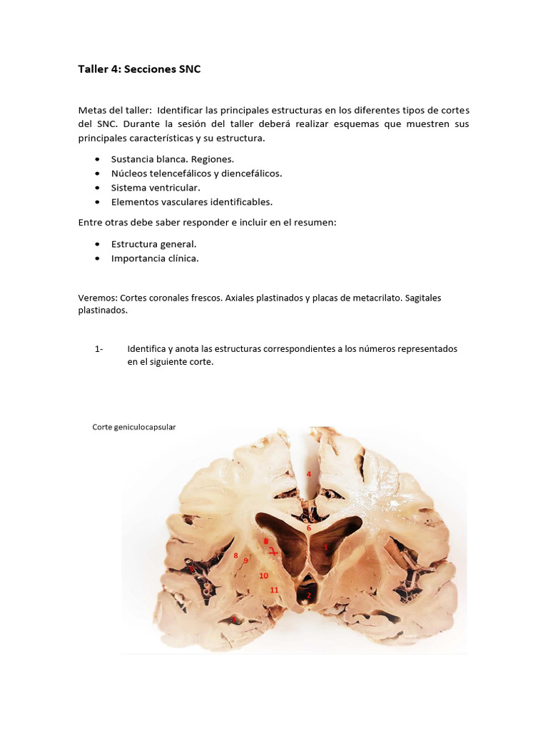 Estructuras del SNC en Cortes Anatómicos | PDF | Sistema nervioso ...