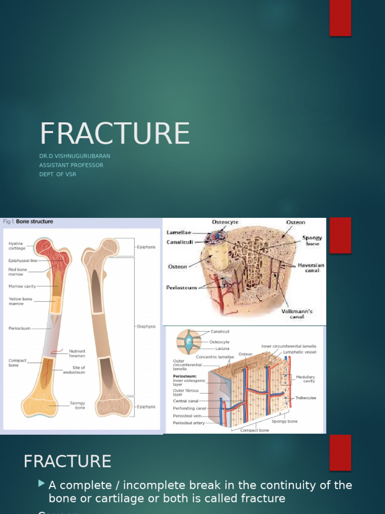 Fracture | PDF | Bone | Osteoblast