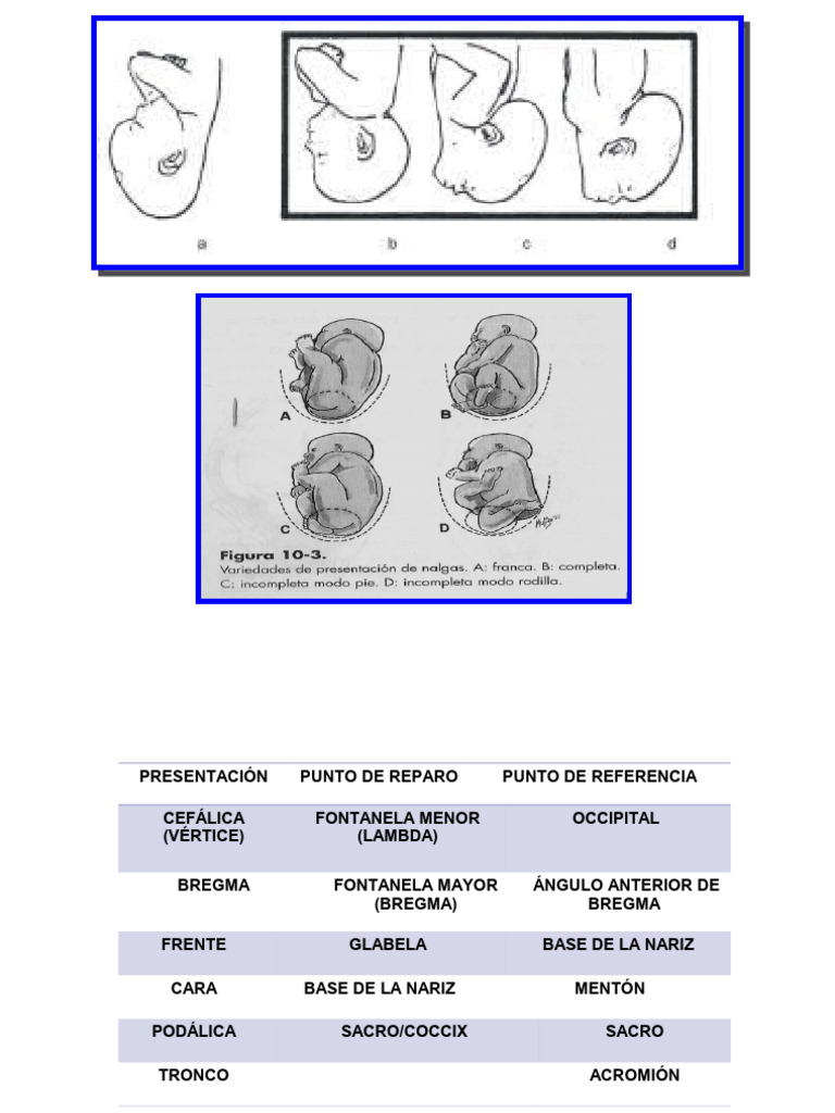 Estática Fetal | PDF