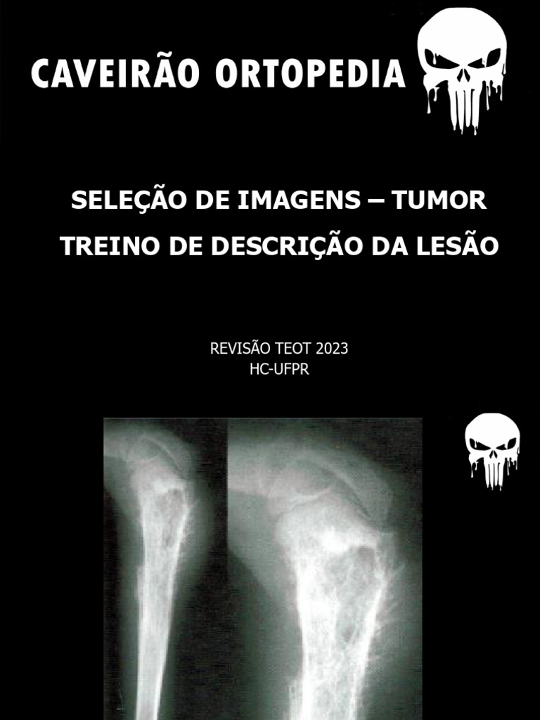 Revisão - Imagens Tumor 2023 | PDF | Casa e Jardim