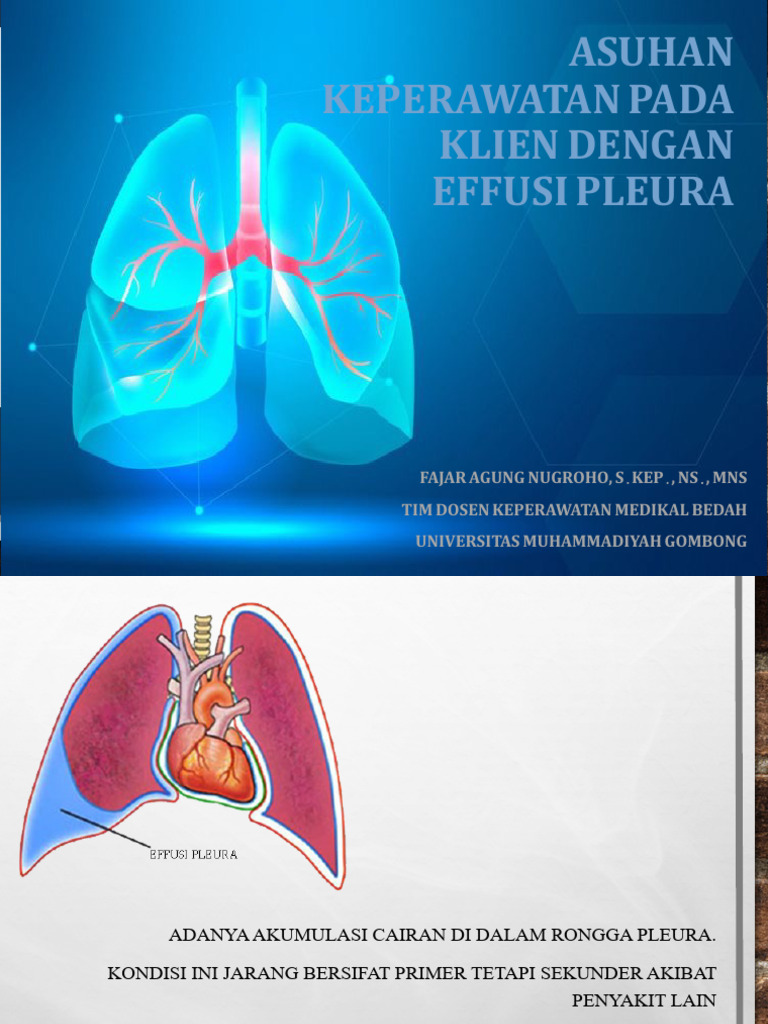 Askep Pada Klien Dengan Efusi Pleura | PDF | Pengembangan Diri | Sains & Matematika