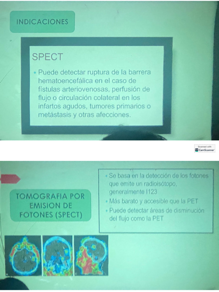 Neuro 2 Optimizadoocr | PDF | Imagen de resonancia magnética ...