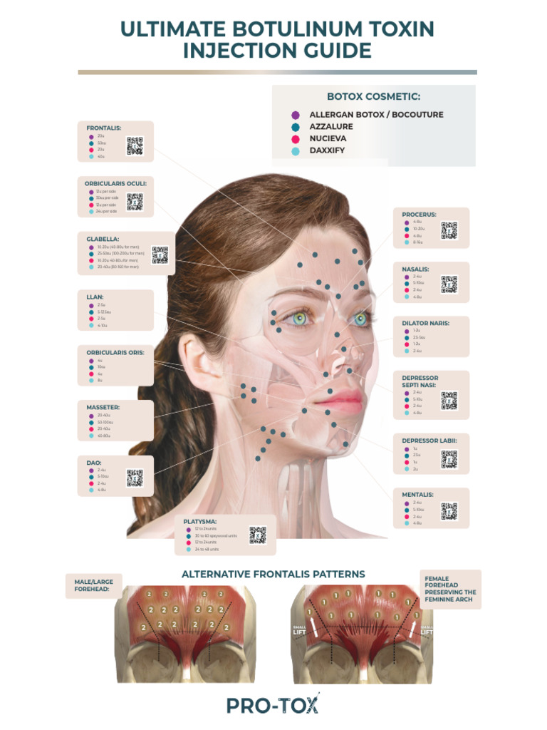 Ultimate Botulinum Toxin Injection Clinician Guide 3 | PDF | Botulinum ...