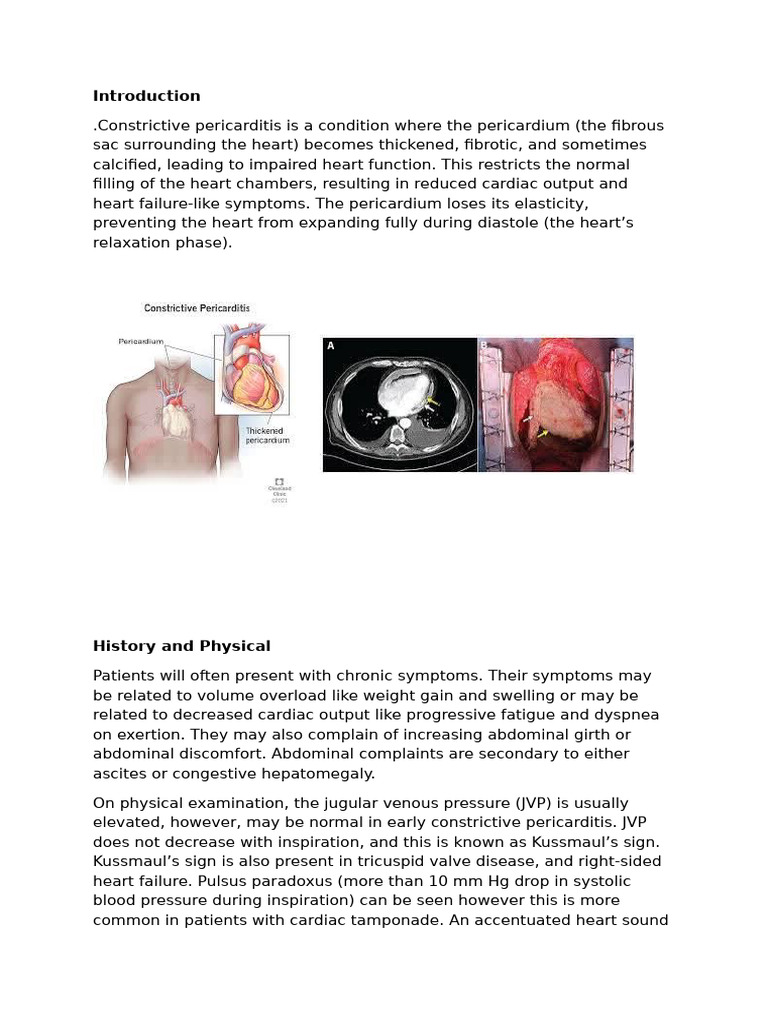 Constrictive Pericarditis | PDF | Heart | Heart Failure