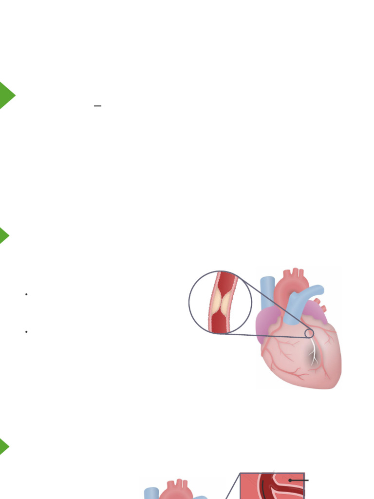 Slides Myocardial Infarction STEMIvs NSTEMI | PDF | Myocardial ...