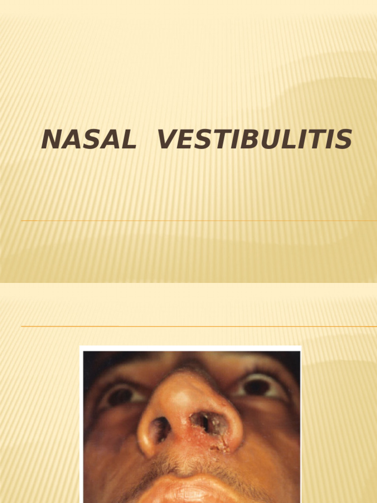Nasal Vestibulitis: Symptoms and Treatment | PDF