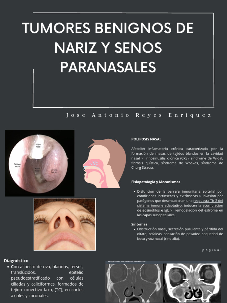 Tumores Benignos de Nariz y Senos Paranasales | PDF | Enfermedades y trastornos | Medicina CLINICA