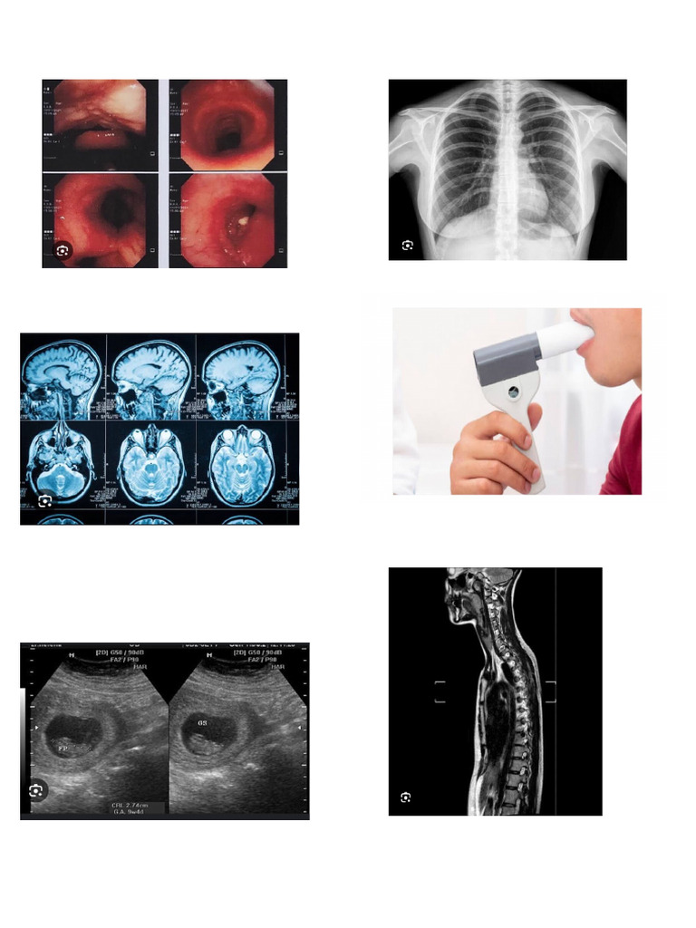 Contoh Hasil Radiologi | PDF