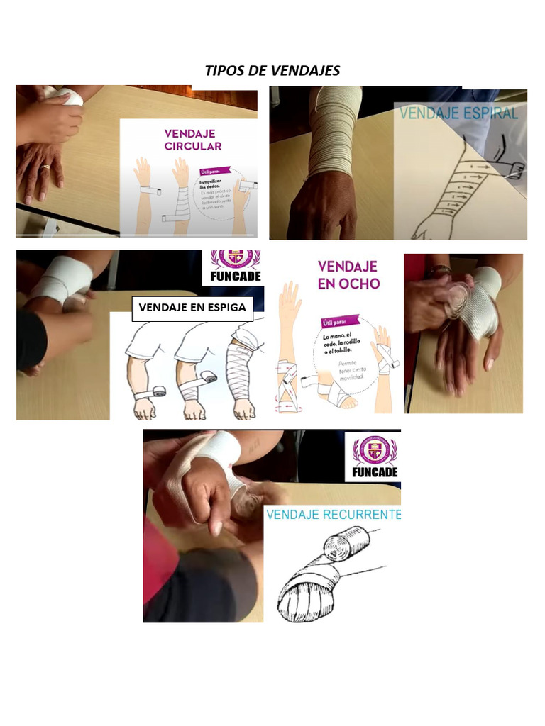 Tipos de Vendajes | PDF