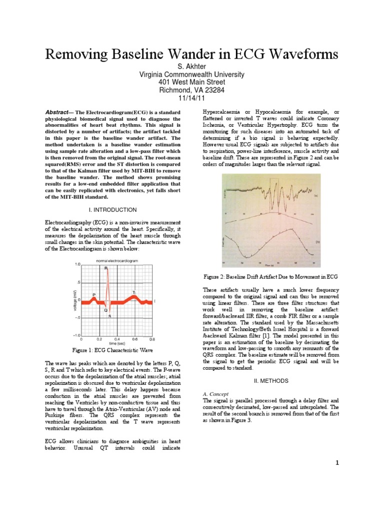 Removing Baseline Wander in ECG Waveforms | PDF | Electrocardiography | Low Pass Filter