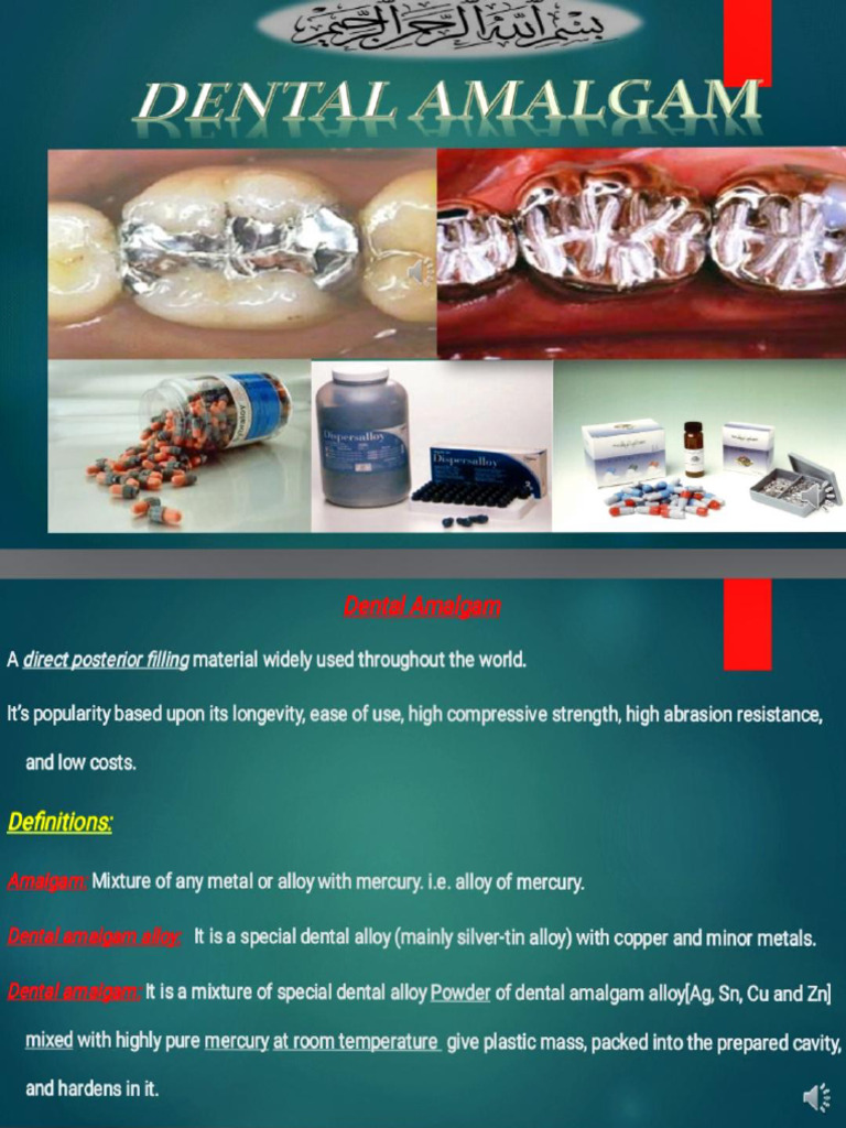 Amalgam | PDF