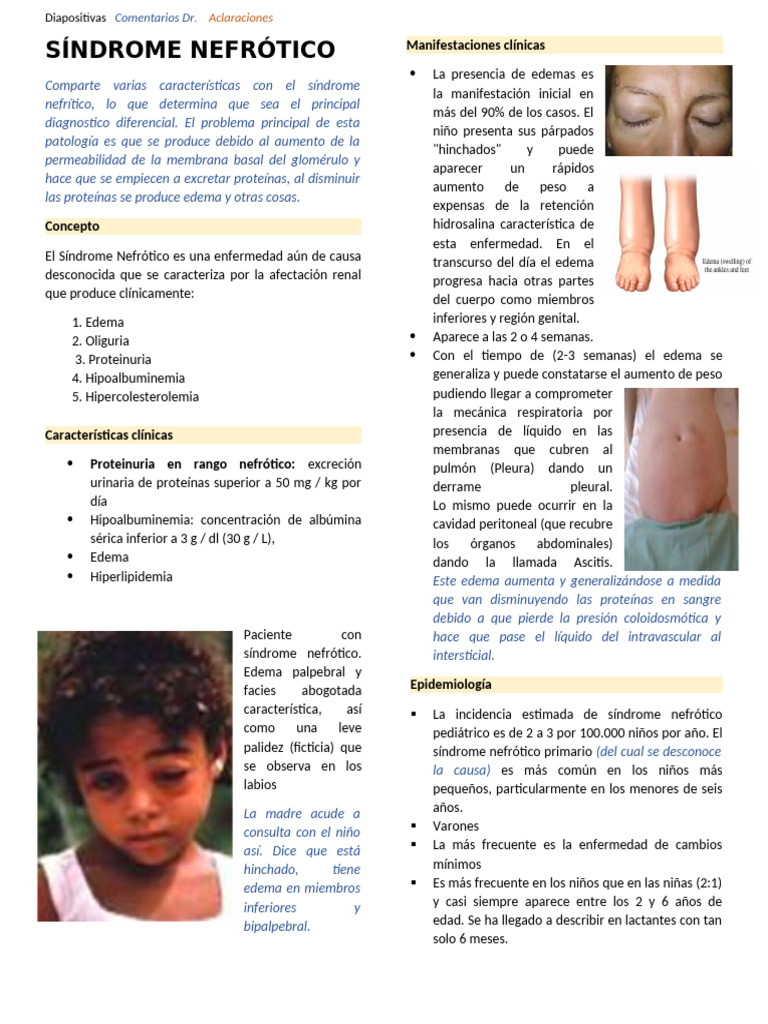 Síndrome Nefrótico en Niños: Diagnóstico y Características | PDF ...