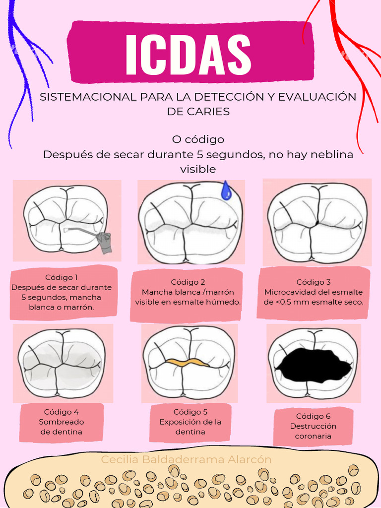 Sistema ICDAS para Detección de Caries | PDF