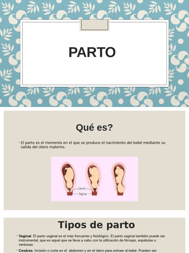 Tipos de Parto y Preparación al Nacimiento | PDF | Salud y bienestar ...
