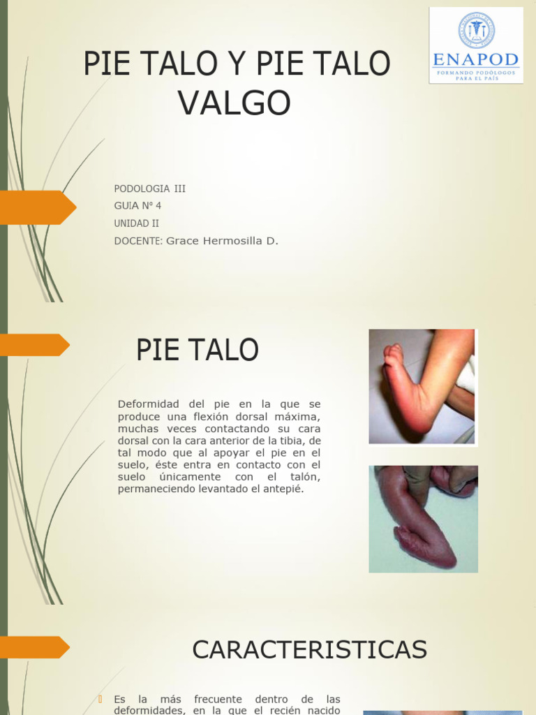 Guía de Podología: Pie Talo y Valgo | PDF | Pie | Parto