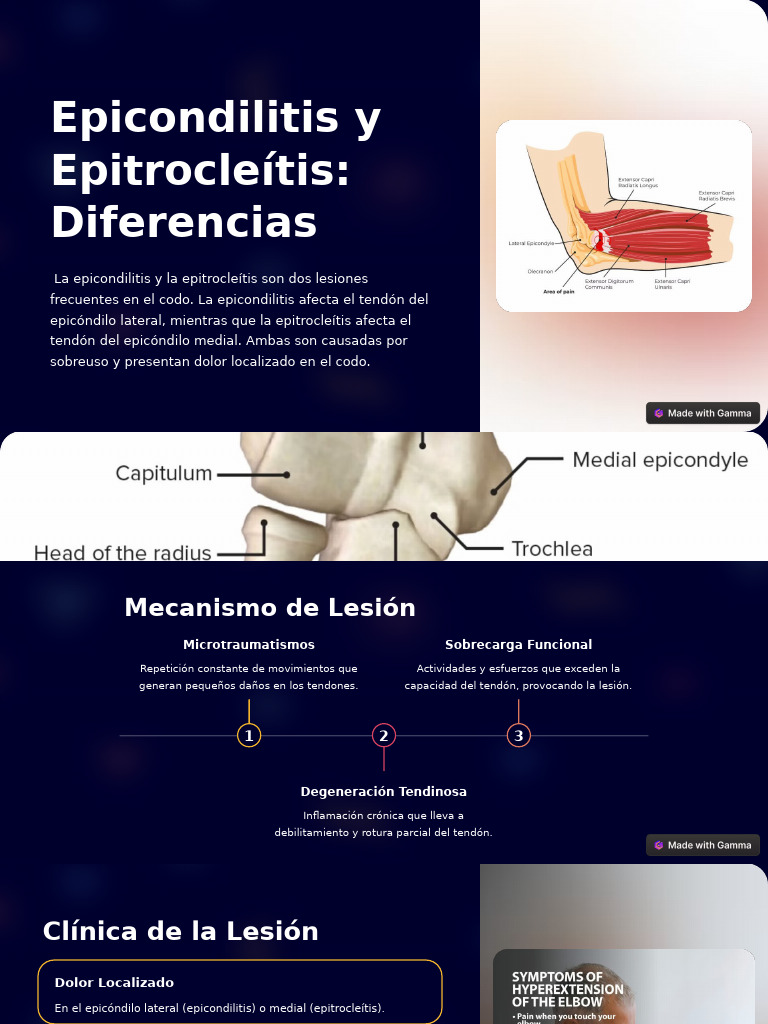 Epicondilitis y Epitrocleitis Diferencias | PDF