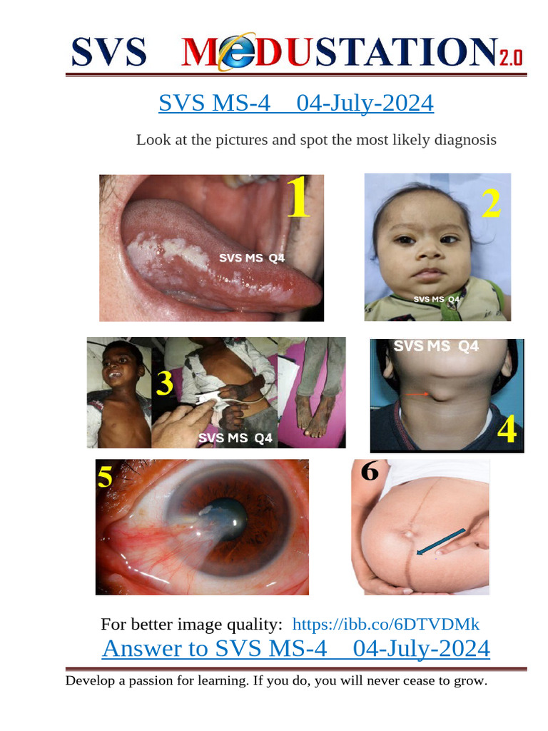 SVS MS-4 04-July-2024: Look at The Pictures and Spot The Most Likely Diagnosis | PDF