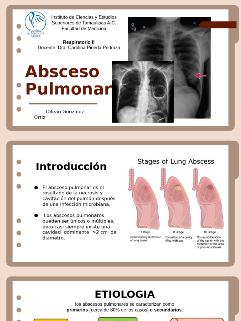 Absceso Pulmonar | PDF | Tos | Causas de la muerte