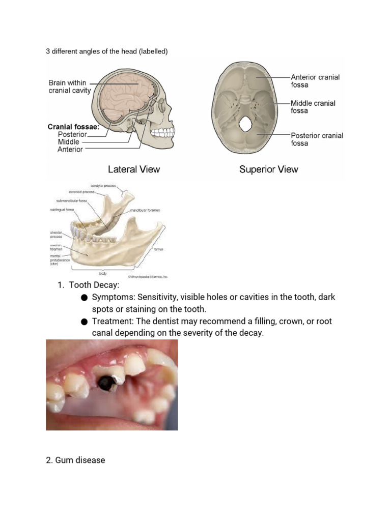 3 Different Angles of The Head (Labelled) | PDF