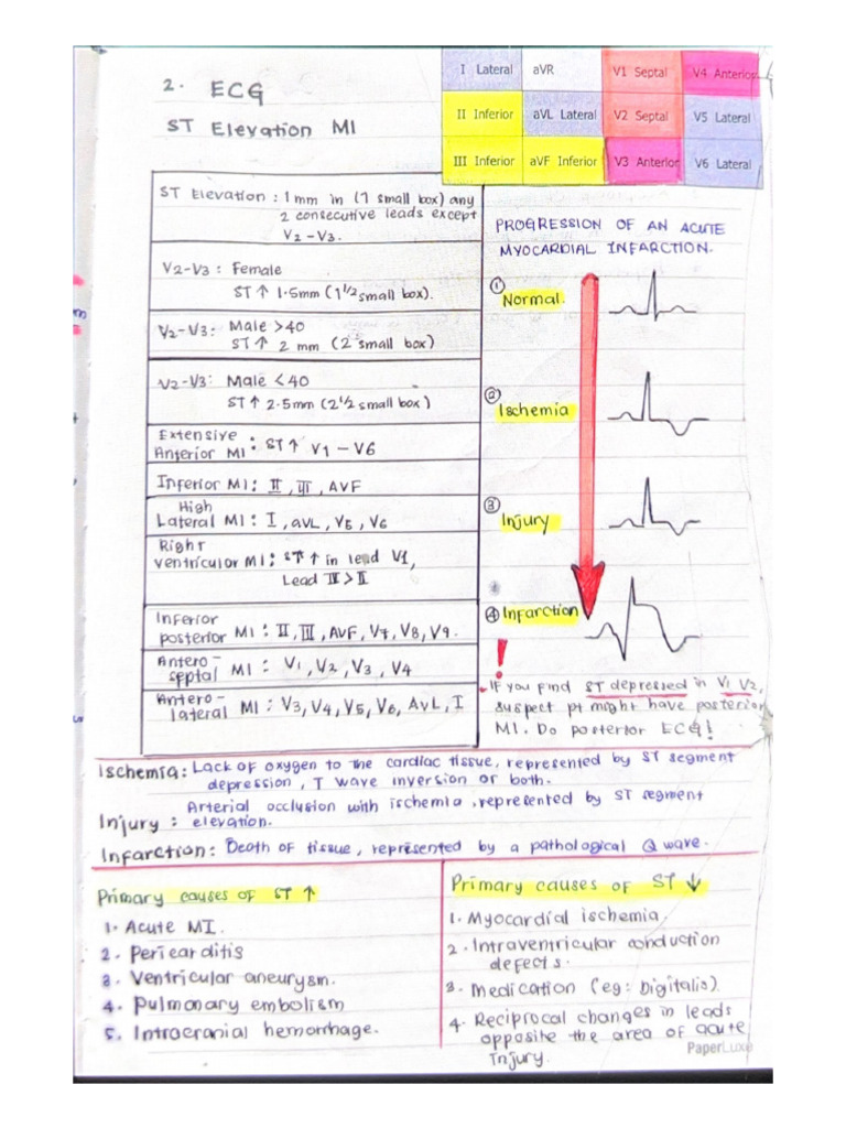Ecg CPD | PDF