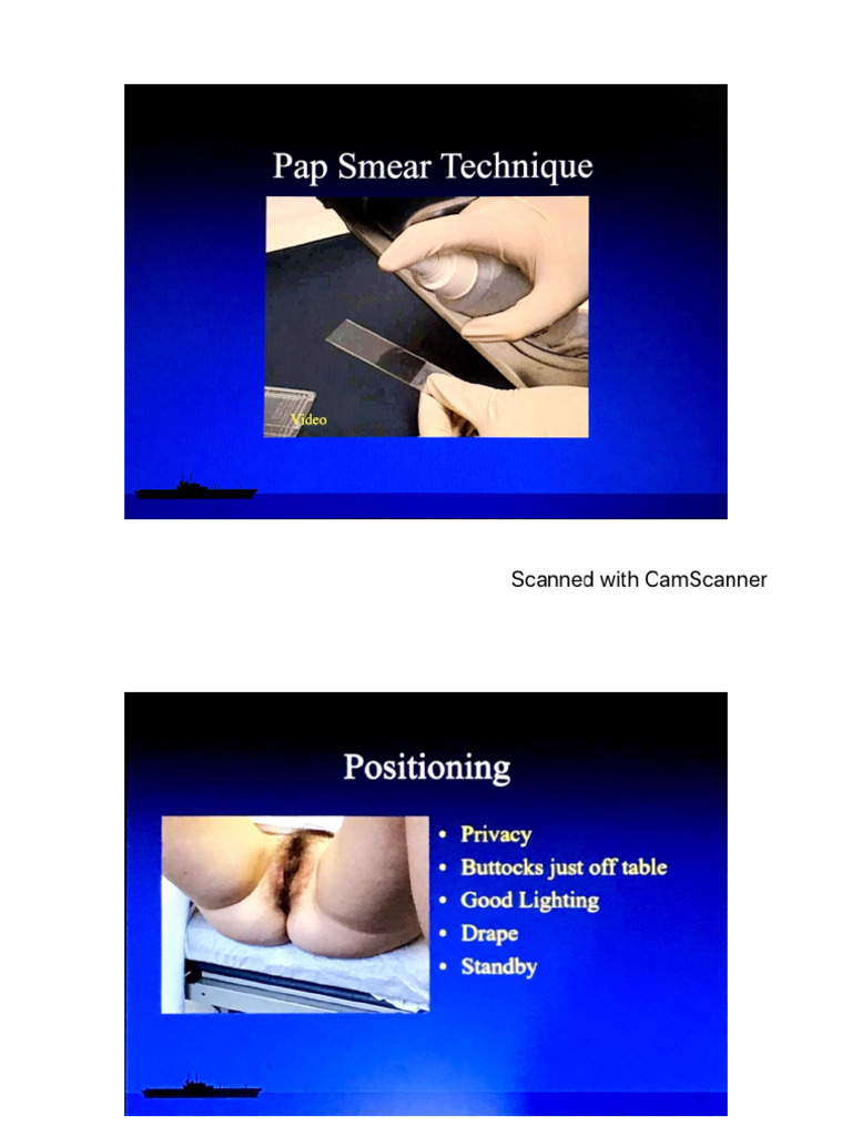 Pap Smear Technique | PDF