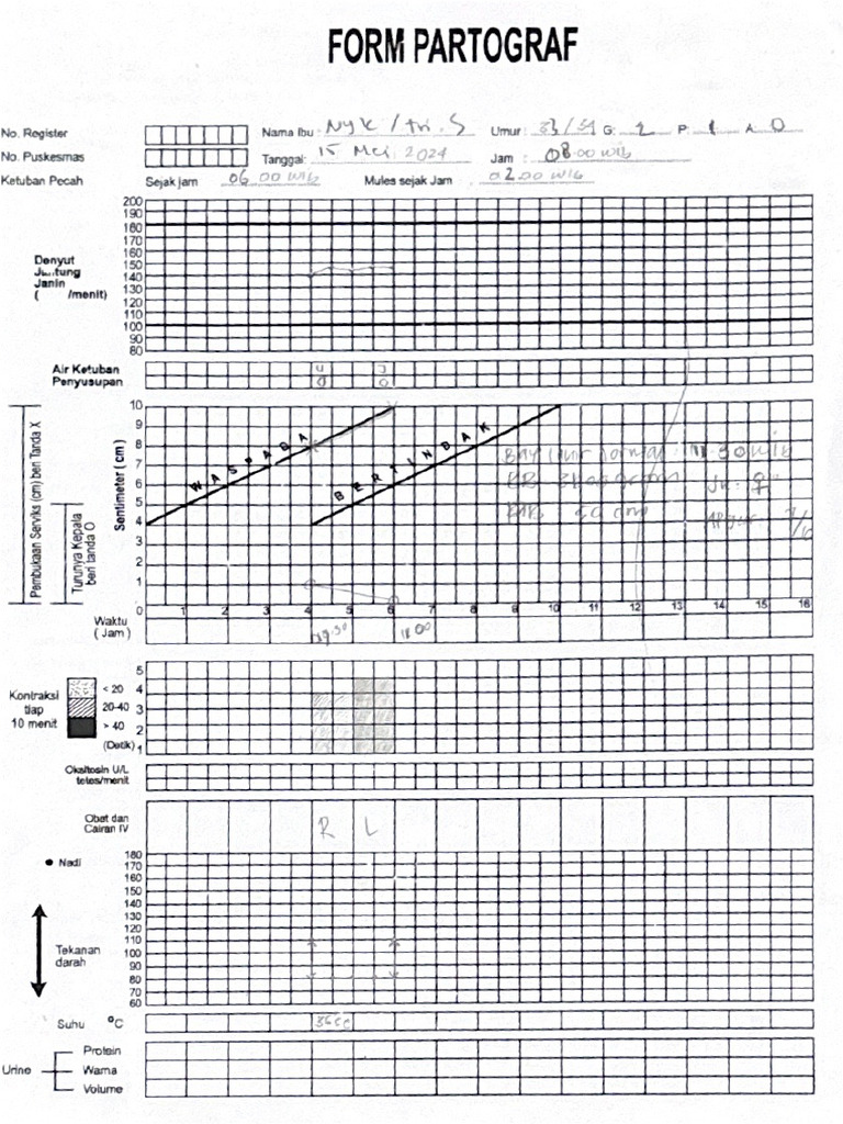 Catatan Partograf Persali | PDF