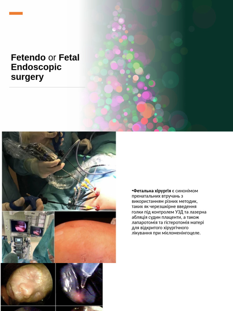 FETENDO | PDF