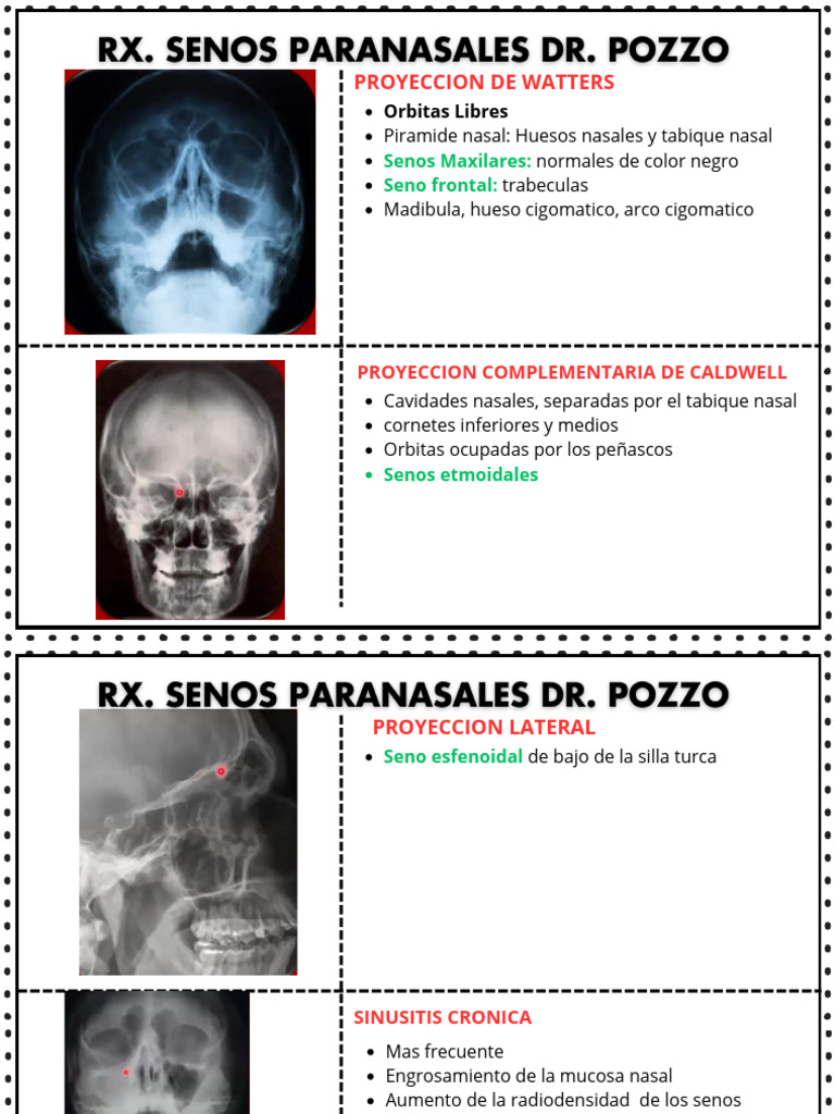 Rx. Senos Paranasales | PDF
