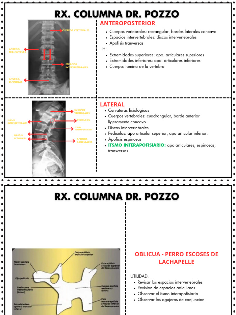 Rx. Columna Vertebral | PDF | Vértebra | La columna vertebral