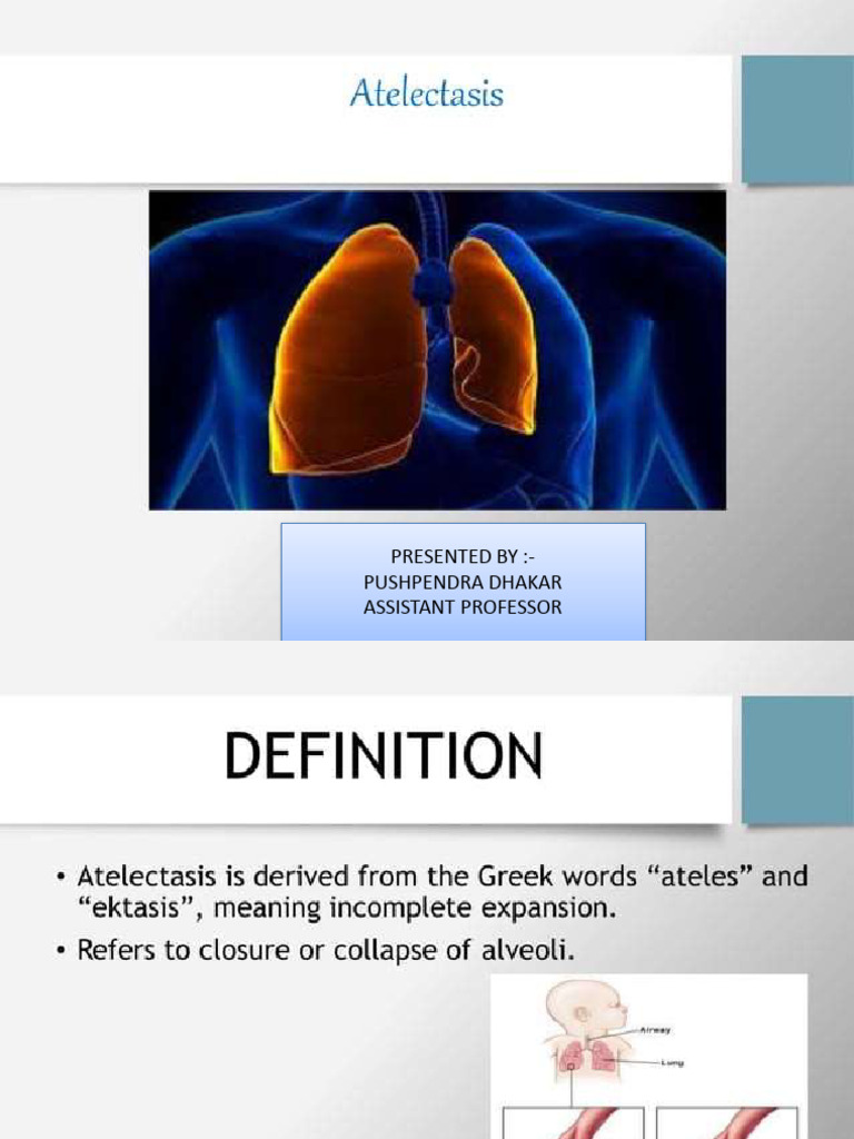 Atelectasis | PDF