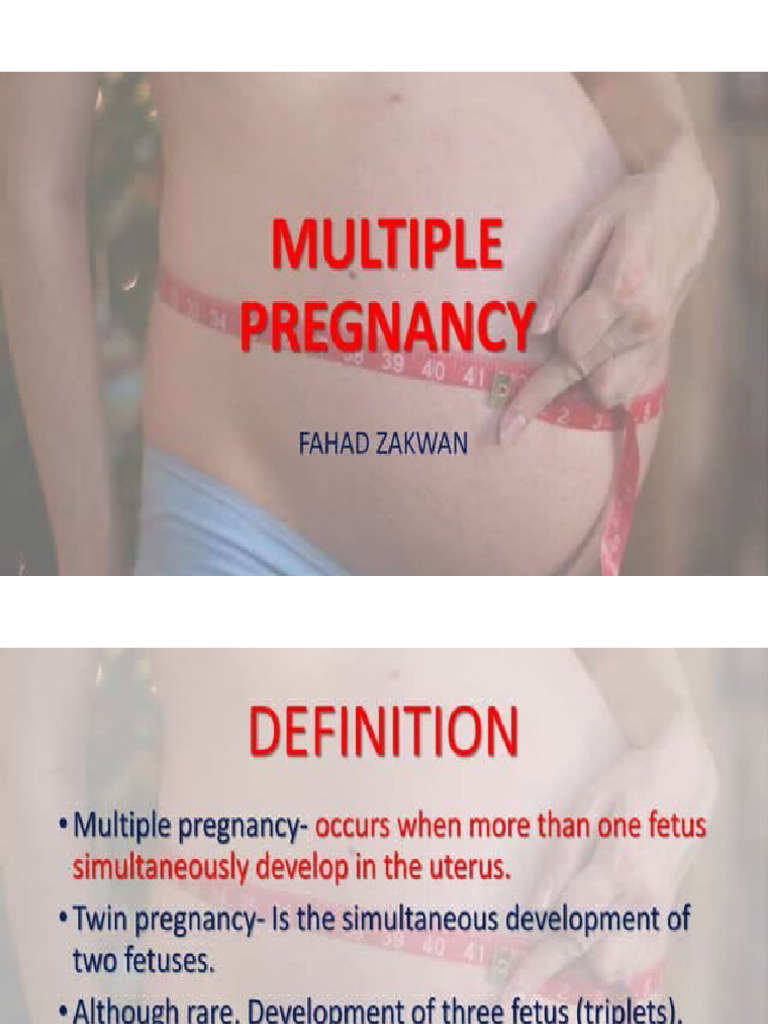 Multiple Pregnancy | PDF