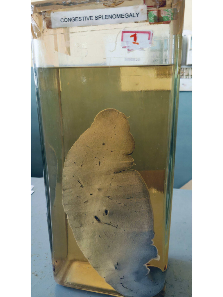 Patho Gross Specimens 2nd Block | PDF