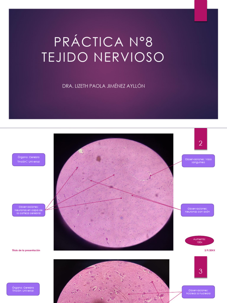 Histología del Cerebelo a 40x | PDF | Cerebelo | Nervio