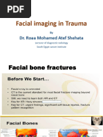 Dental Clasp Design Guide | PDF | Mouth | Tooth