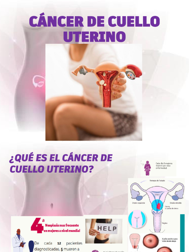 Cancer de Cuello Uterino | PDF
