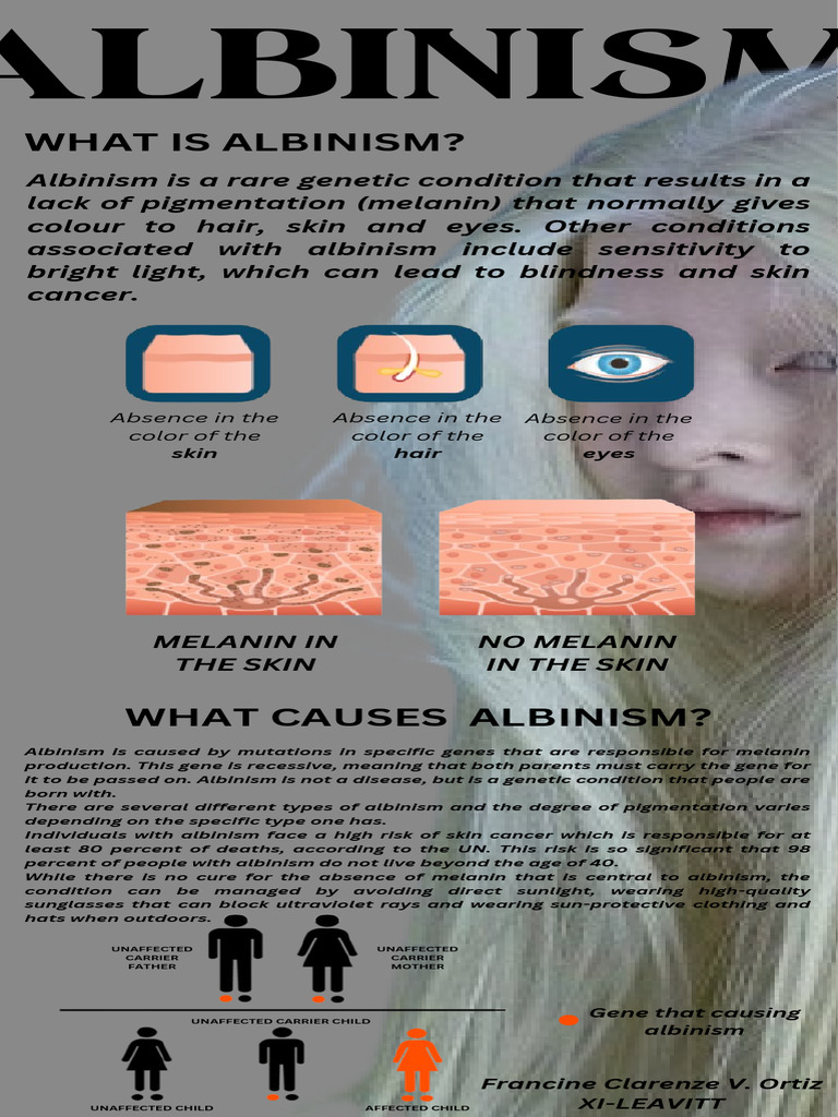 ALBINISM | PDF