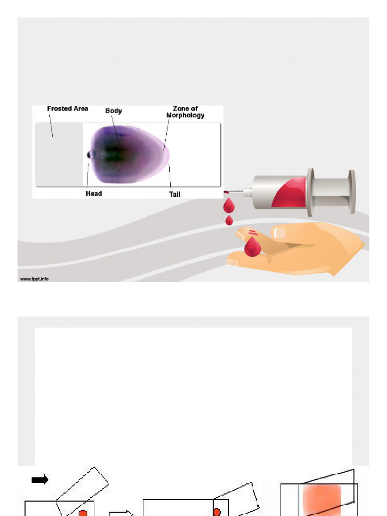 Bloodfilmexamination 160419062038 | PDF | Anemia | Red Blood Cell