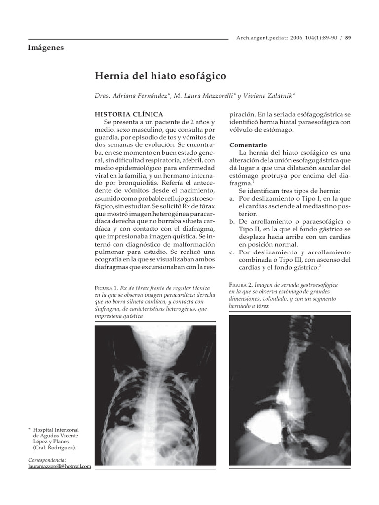 Hernia Del Hiato Esofágico: Imágenes | PDF | Enfermedades y trastornos ...