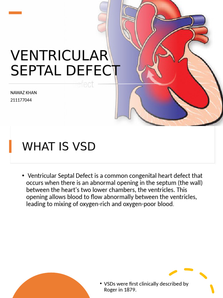 Understanding Ventricular Septal Defect | PDF | Ventricle (Heart ...